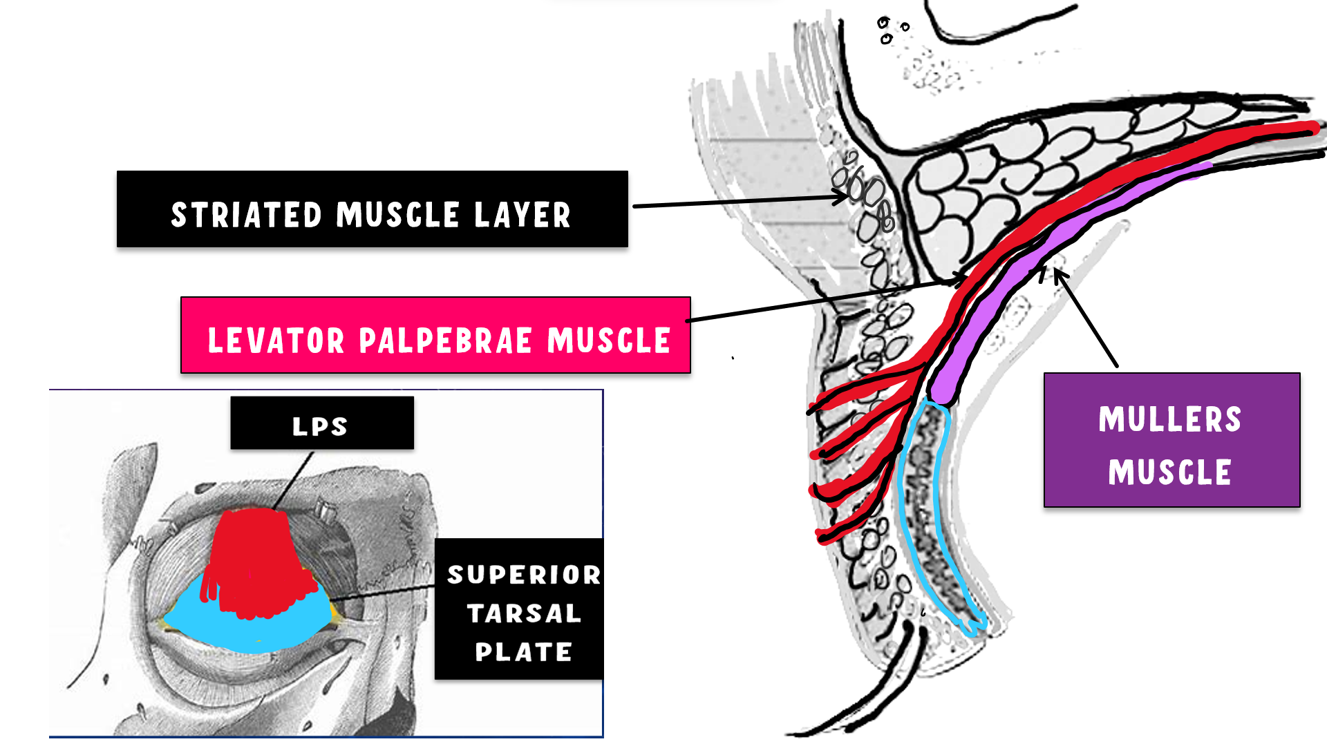 Anatomy of Eyelid Made Easy - INSIGHT OPHTHALMOLOGY