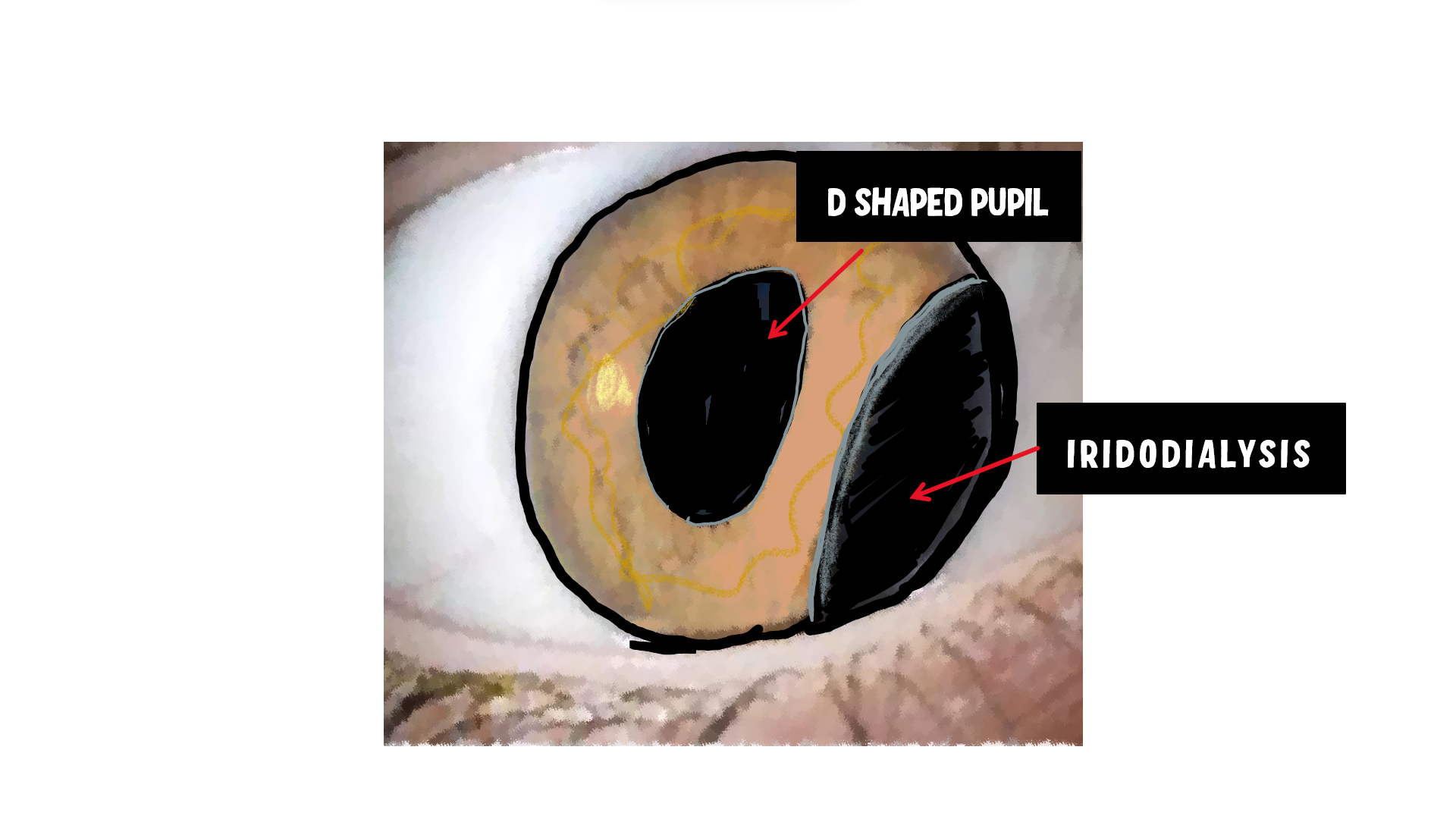 Anatomy Of Angle and Anterior Chamber of Eye - INSIGHT OPHTHALMOLOGY