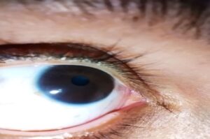 Anatomy of Lacrimal Apparatus Made Insanely Easy - INSIGHT OPHTHALMOLOGY